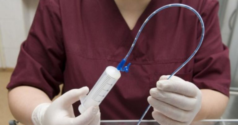 Understanding Bulbar ALS | ALS United Orange County